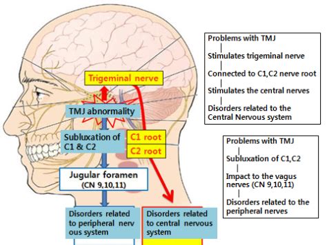 Importance Of TMJ Lee Babe Jun Clinic Of Korean Medicine