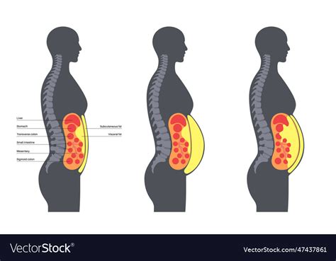 Visceral Fat Diagram Royalty Free Vector Image