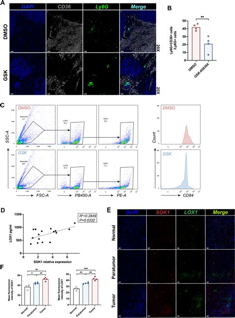 Gsk 650394 Inhibits The Activation Of Pmn Mdscs In Crlm Mice After Ir Download Scientific