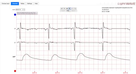 PhysioNet MIMIC WFDB Tutorials