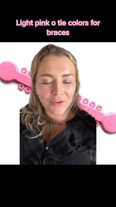 Pink Braces Artofit