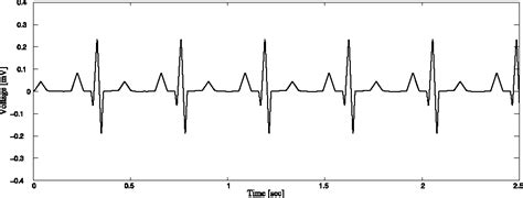 Figure 2 From Extracting Fetal Heart Signal From Noisy Maternal Ecg By Multivariate Singular
