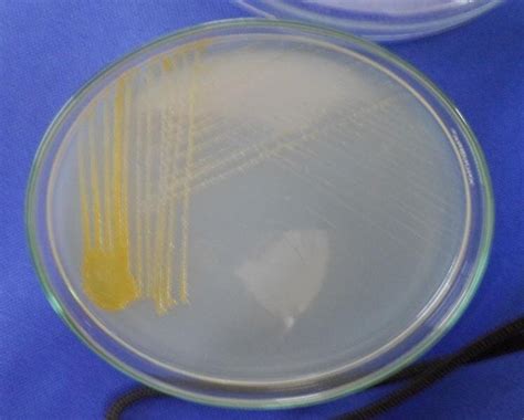 Isolated Colonies Of Staphylococcus Aureus Sample 7 Round Mucoid Download Scientific