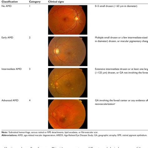 Pdf Recent Developments In Age Related Macular Degeneration A Review