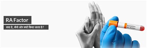 Ra Factor परीक्षण क्या है कैसे और क्यों किया जाता है