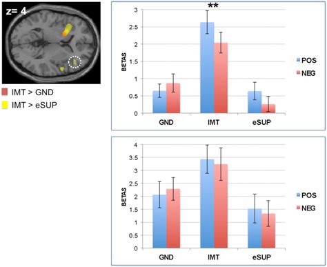 Modulation Of Brain Areas Associated With Affective Processes Left