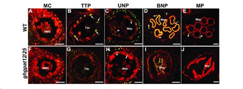 Tunel Assay For The Detection Of Dna Fragmentation In Anthers Of Hm 1
