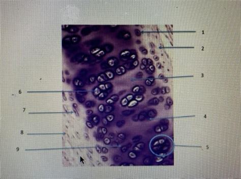 Solved Identify The Pointed Structures Unless Chegg