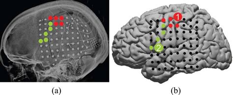 Experiment 2 Position Of The Ecog Electrode Array A Head X Ray Of Download Scientific