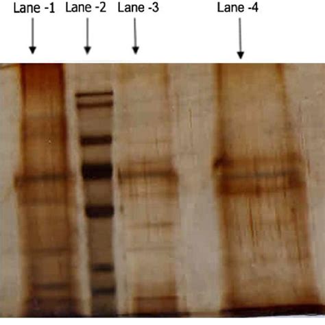 A Hyperbolic Curve Substrate Velocity Curve Of Enzyme Catalyzed