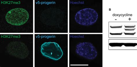 Doxycycline Inducible Expression Of Progerin In Proliferating Primary Download Scientific