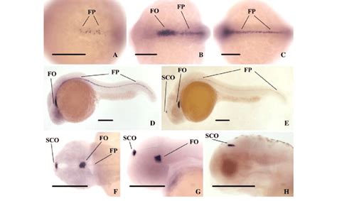 Scale Bar 025 Mm In Situ Hybridization Pattern Of Danio Rerio