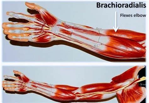 Brachioradialis Muscle PT Master Guide Radial Nerve Extensor Muscles Tennis Elbow Master