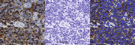 The Integration Of Deep Learning Methods To Improve Nuclei Detection And Segmentation — Oraclebio