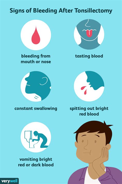 Bleeding After A Tonsillectomy