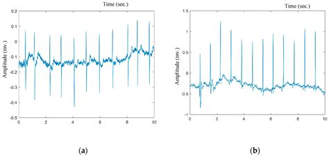 applied sciences free full text p wave detection using a fully