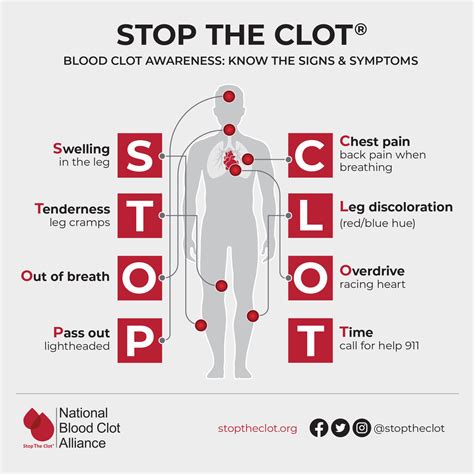 Blood Clot Info Risks Symptoms Treatment And Prevention