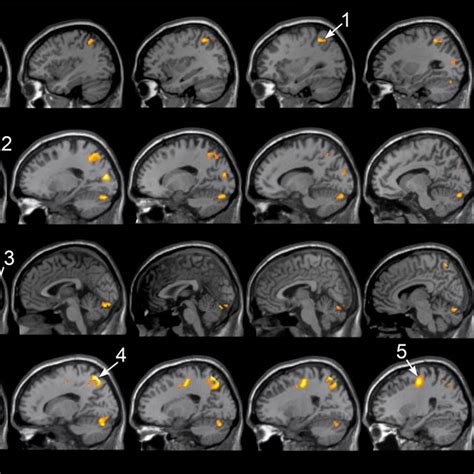 Differences In Task Based Neural Activity At Decision Points Between