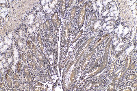 IHCeasy LOX Ready To Use IHC Kit KHC0630 Proteintech