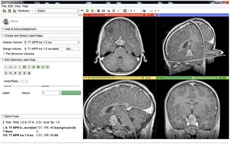 3d slicer interface with the slicer editor on the left side and a