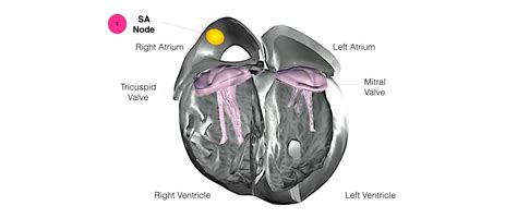 Atrial Flutter Ablation One Heart Cardiology