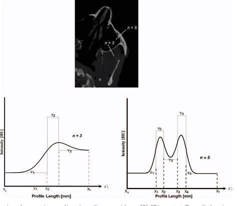 Figure 2 From Model Based Psf And Mtf Estimation And Validation From