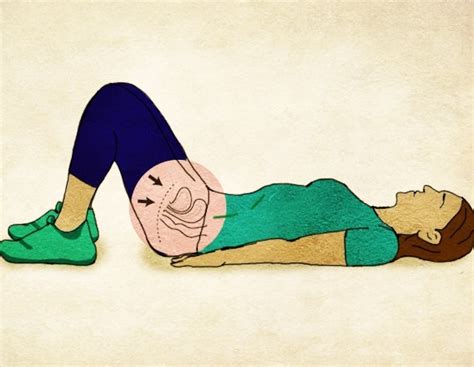 Abdominal Diastasis