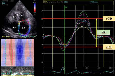 Contractile And Conduit Function The Initial Negative Deflection