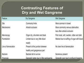 Gangrene Pptx