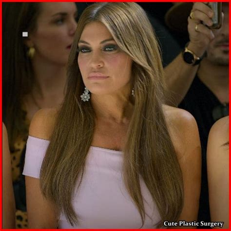 Has Kimberly Guilfoyle Undergone Breast Implants Celebrities Plastic