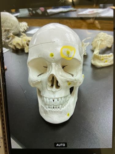 Bio 225 Lab 6 Flashcards Quizlet
