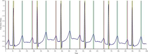 Time Series Event Detection Example Using The Presented Swiftevent Download Scientific Diagram