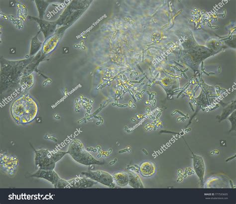 Cell Culture Bacterial Contamination At Monte Rodriquez Blog
