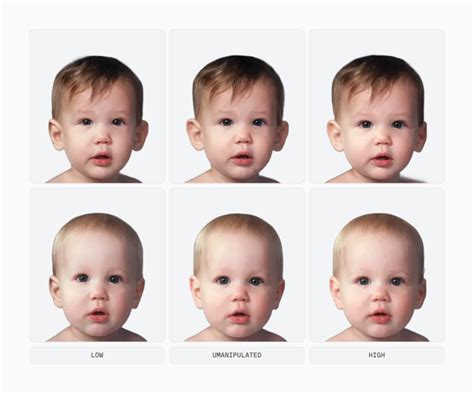 Facial Neoteny An Evidence Based Guide