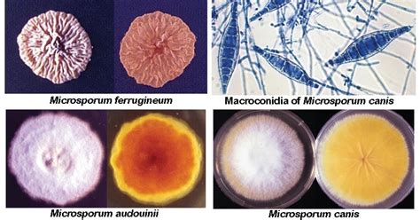 Microsporum Spp An Overview