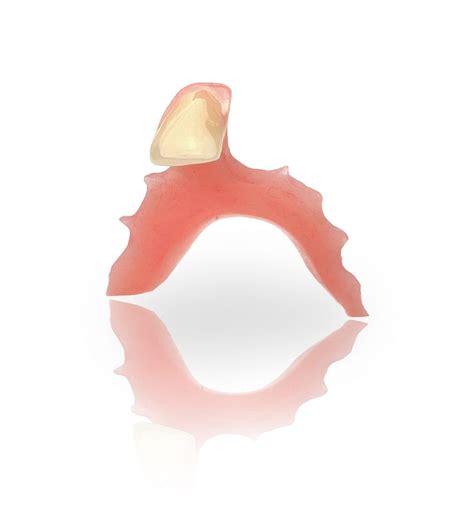 Flipper Tooth Replacement