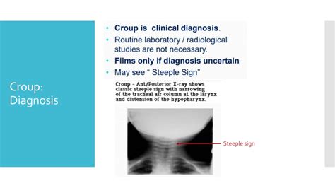 Ppt ‘tis The Season Croup Bronchiolitis And Influenza Powerpoint