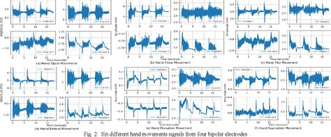 Figure 2 From An Onset Based Approach For Feature Extraction And Classification Of Emg Signals