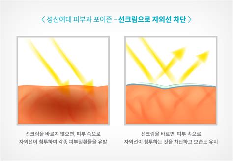 ﻿대학로 피부과 피부관리 자외선 차단에 신경 써야 하는 봄이 왔습니다 성신여대 포이즌 피부칼럼 성신여대피부과 포이즌의원
