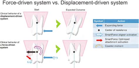 Figure 6 From Product Review And Demonstration Of The Invisalign Clear