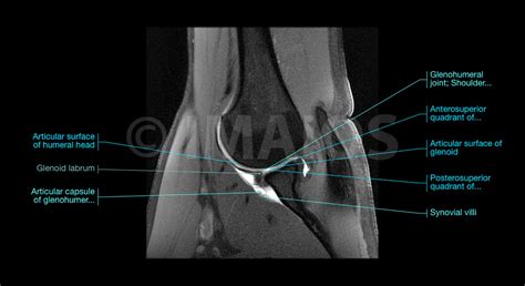 Shoulder Mr Arthrogram E Anatomy