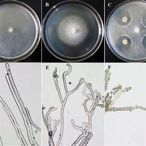Pdf Comparative Transcriptome Analysis Of Sclerotinia Sclerotiorum Revealed Its Response