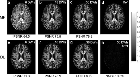 Figure 1 From Deep Learning For Highly Accelerated Diffusion Tensor Imaging Semantic Scholar