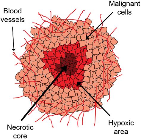 Schematic Representation Of A Solid Tumor Mass The Different Shades Of
