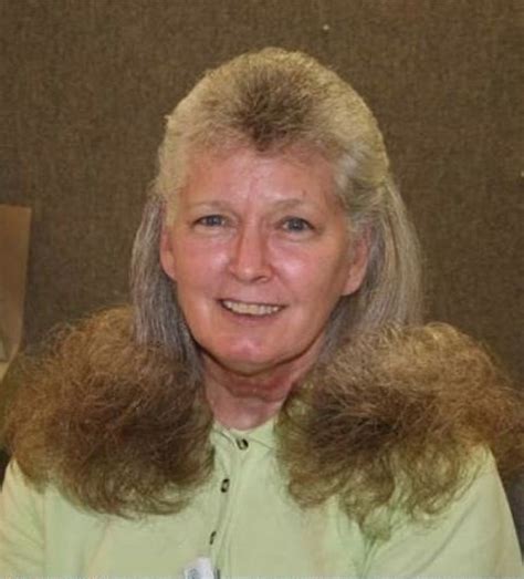 Bull Dyke Going Bald Named Patt Explanation Hairlosstalk Forums