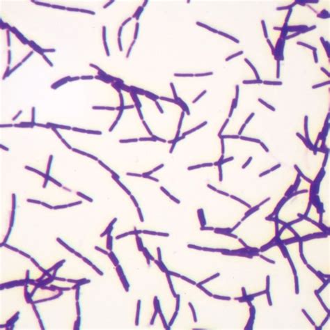 Bacillus Gram Stain Positive