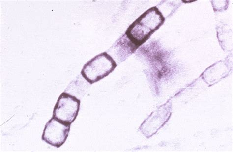 Dimorphic Fungi Disease Properties • Microbe Online