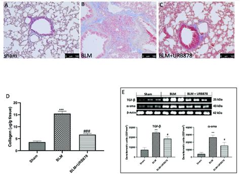 Urb878 Decreased Bleomycin Induced Fibrosis A Sham B Bleomycin Download Scientific
