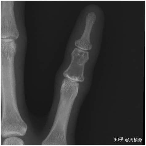 PMID 31853371 知乎