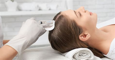 Scalp Micropigmentation Singapore